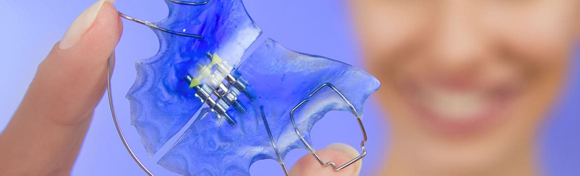 Retainer Instructions in Clinton Hill Ny | Hanson Place Orthodontics