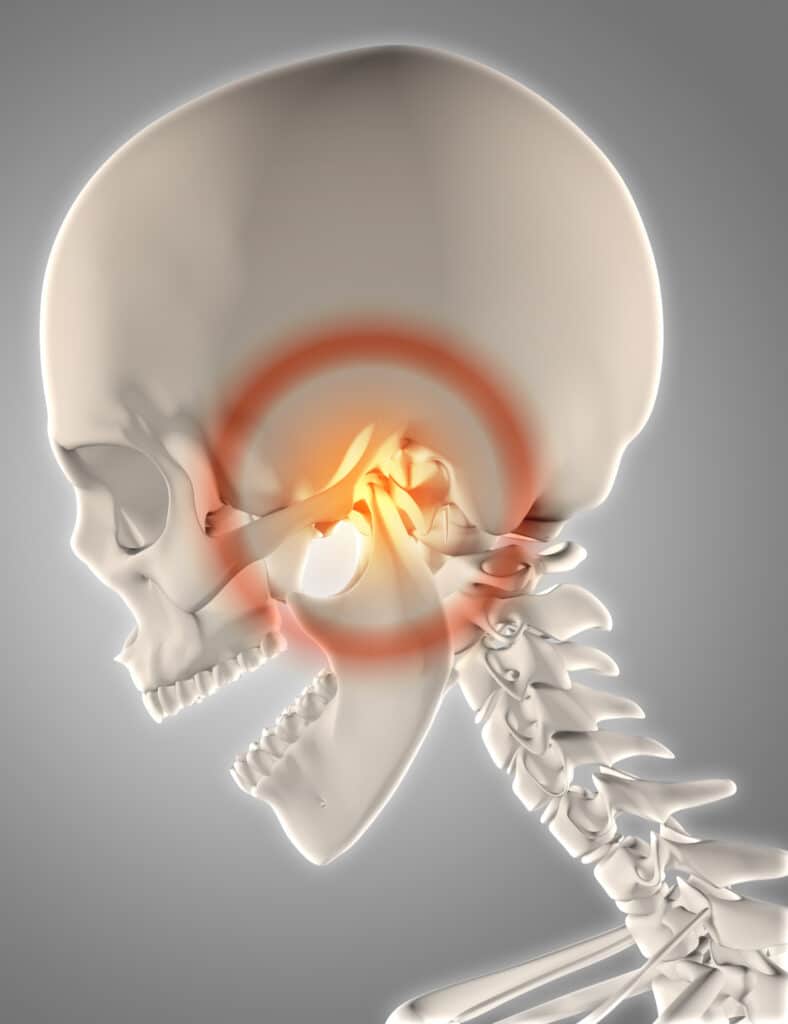 Orthodontics and Jaw Pain: Causes and Solutions